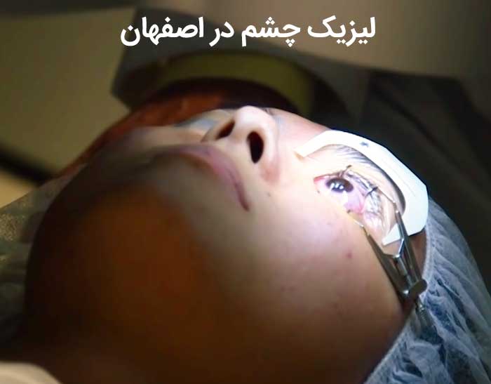 عمل لیزیک چشم در اصفهان - مرکز چشم پزشکی چشمان
